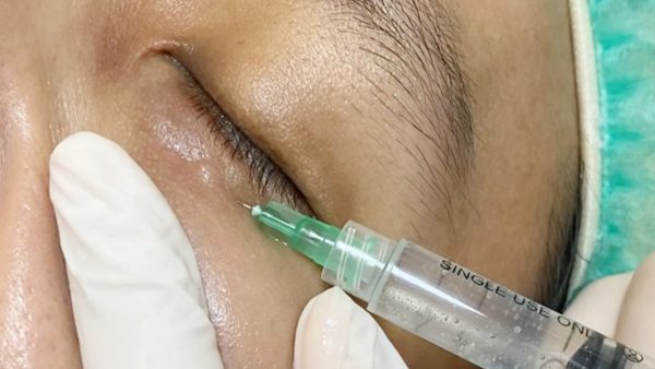 EYE BOOSTER - NanoGlow Aestetic Clinic