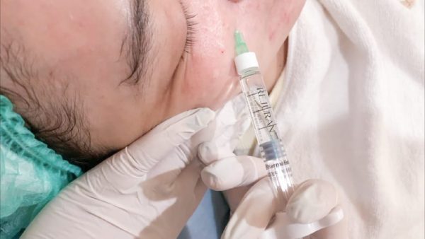 DNA SKIN REPAIR - NanoGlow Aestetic Clinic