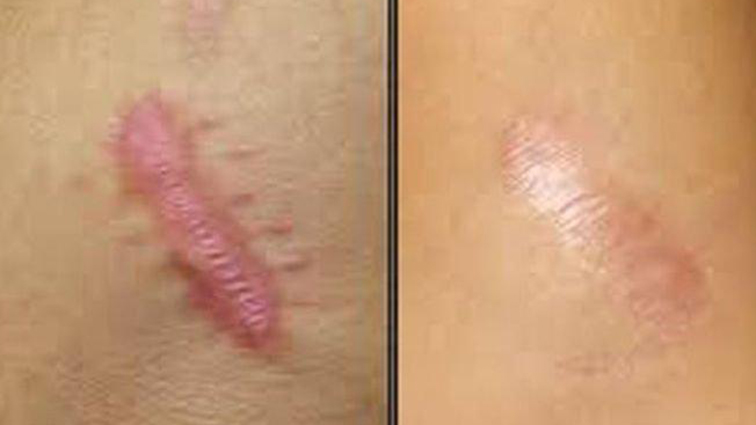 Home - NanoGlow Aestetic Clinic