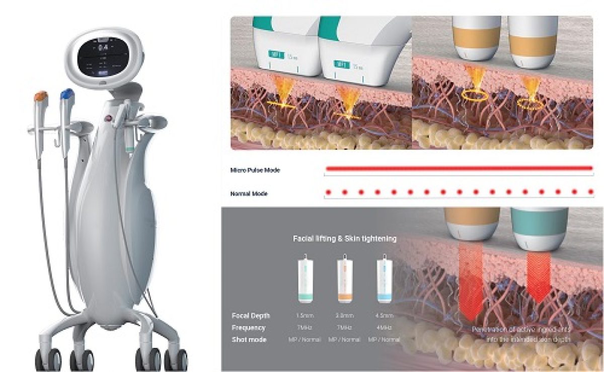 Perbedaan ULTRAFORMER MPT dengan VOLNEWMER - NanoGlow Aestetic Clinic